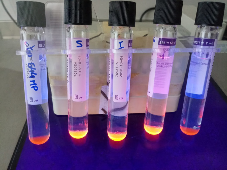 Módulo 2 - Diagnóstico laboratorial da tuberculose drogarresistente